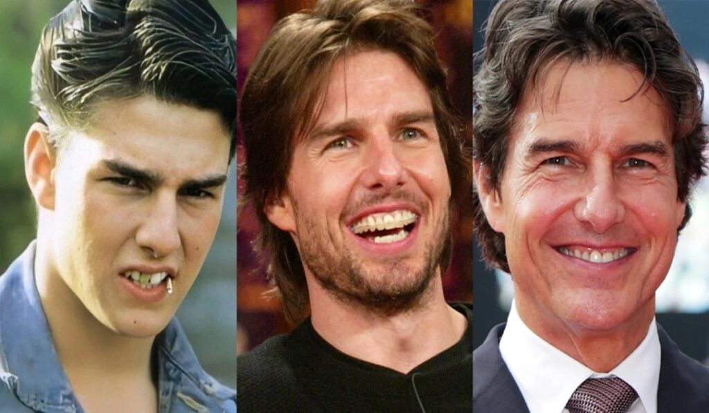 Tom Cruise's Teeth: The Journey to a Radiant Smile